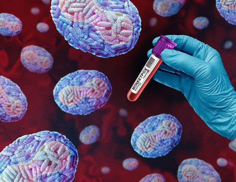 Nowy, śmiertelny szczep wirusa mpox jest "bardzo