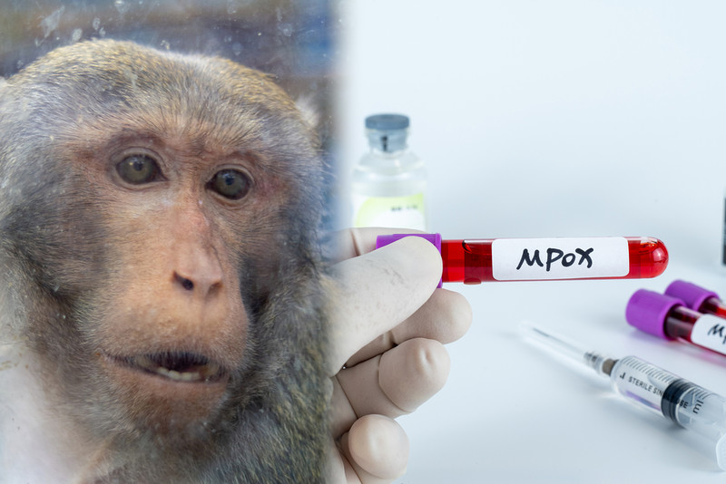 EU agency warns of increase in monkeypox cases Europe